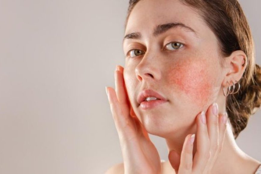 Contact Dermatitis - All Skin Problems | Expert Skin Care Tips ...